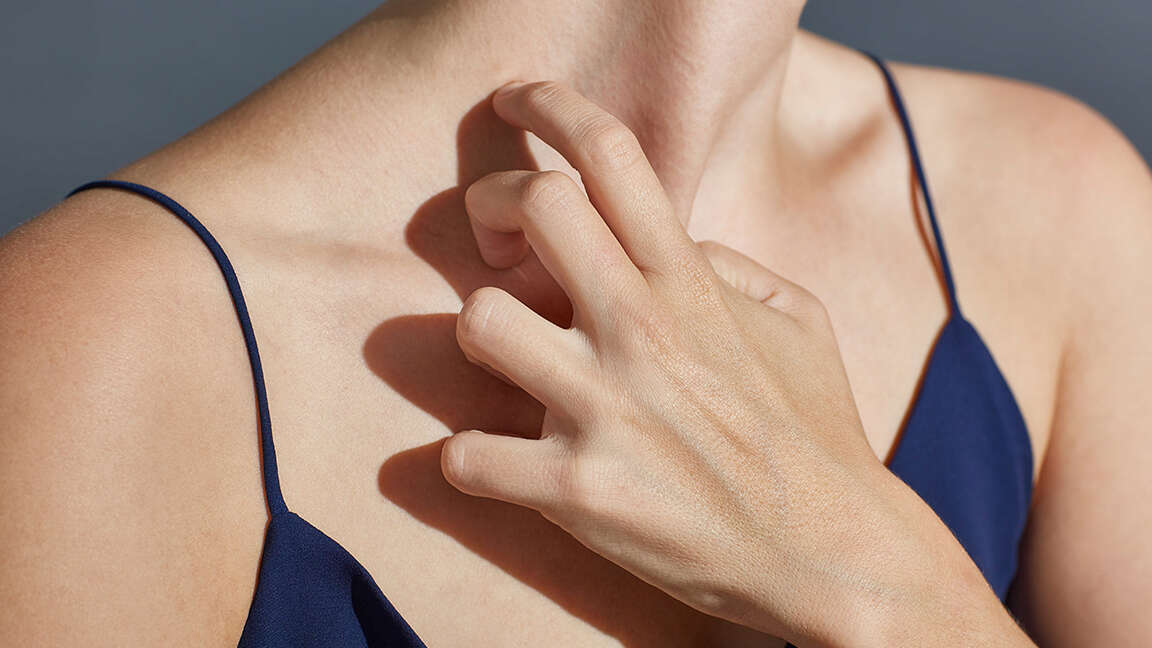 Sonnenallergie – was ist das eigentlich genau? Und was hilft dagegen ...